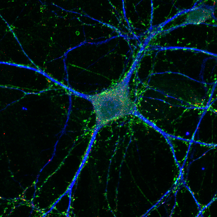 Neurona en acción :: cienciaenimagenes-pasteur